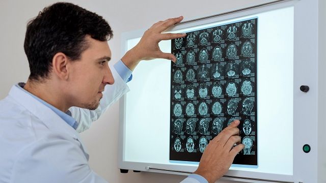 UAB First In U.S. To Use Hyperarc High-Definition Radiotherapy On Brain ...